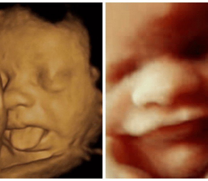 Bebês choram dentro da barriga da mãe- Segundo Estudo